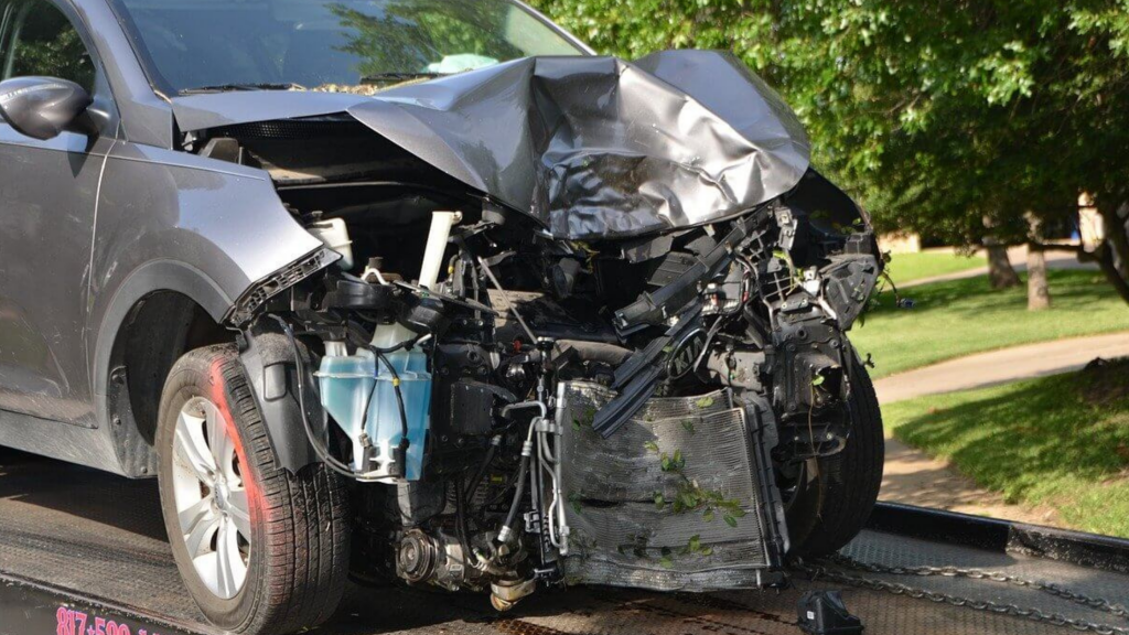 Amputação Traumática: O que é, Principais Causas, Desafios Psicológicos