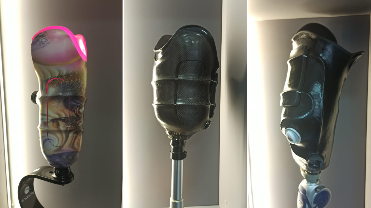 A Evolução dos Encaixes para Próteses Ortopédicas