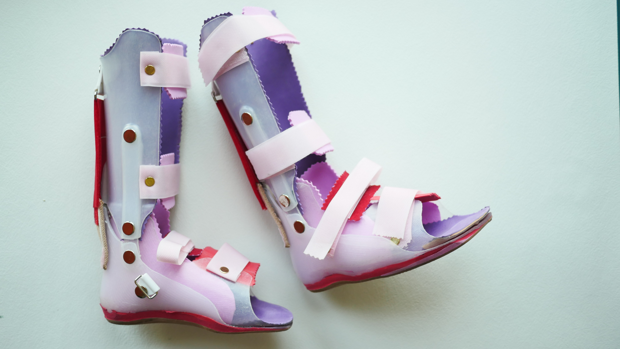 Órtese: por que usar e quando deve ser usada?