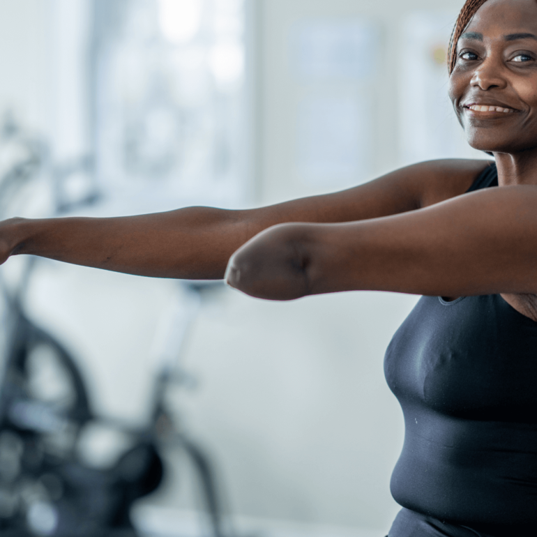 Amputação de pé: Conheça os Tipos, Causas e Próteses