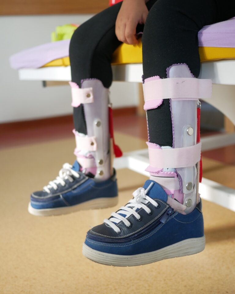 AFO: Tipos, indicações e quando usar